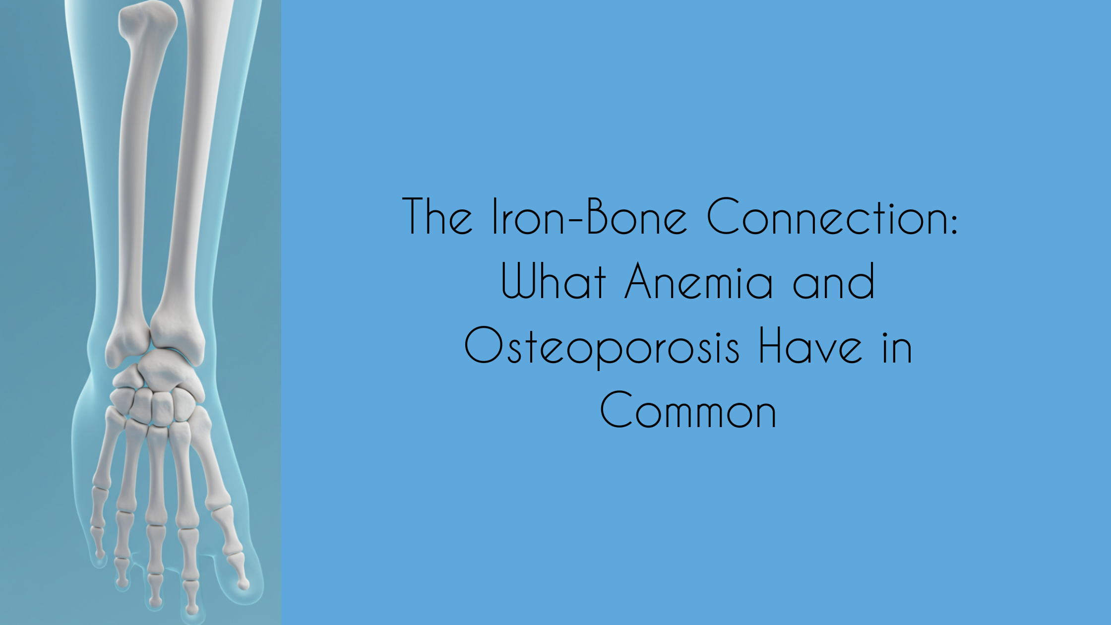 The Iron-Bone Connection: What Anemia and Osteoporosis Have in Common ...